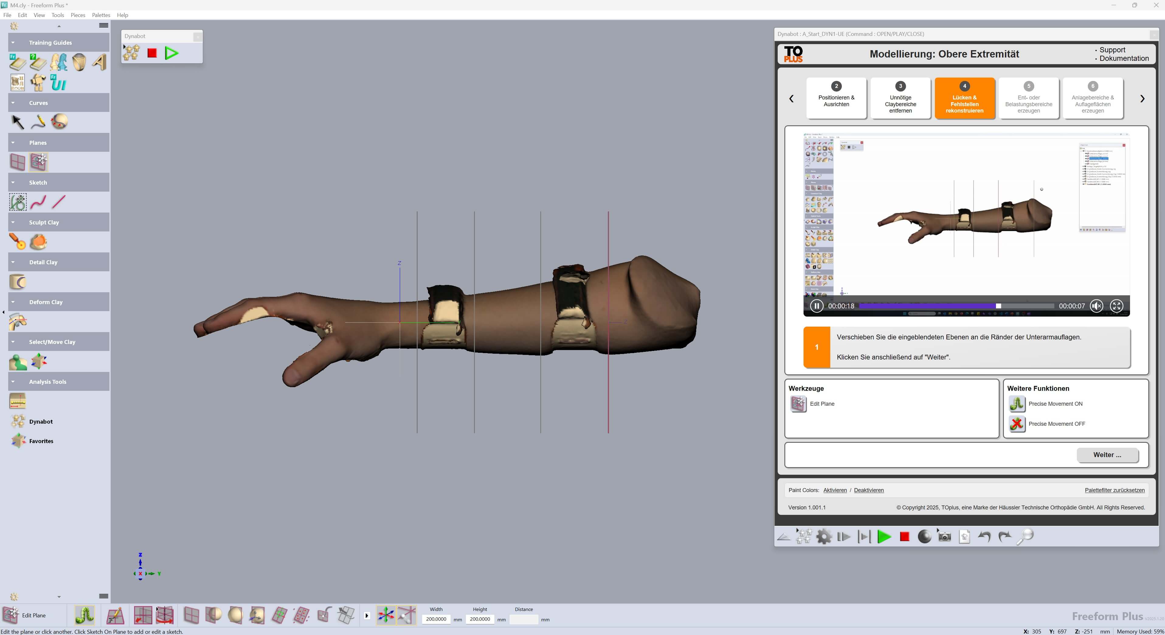 Automating 3D modelling in O&P with Freeform | Hexagon